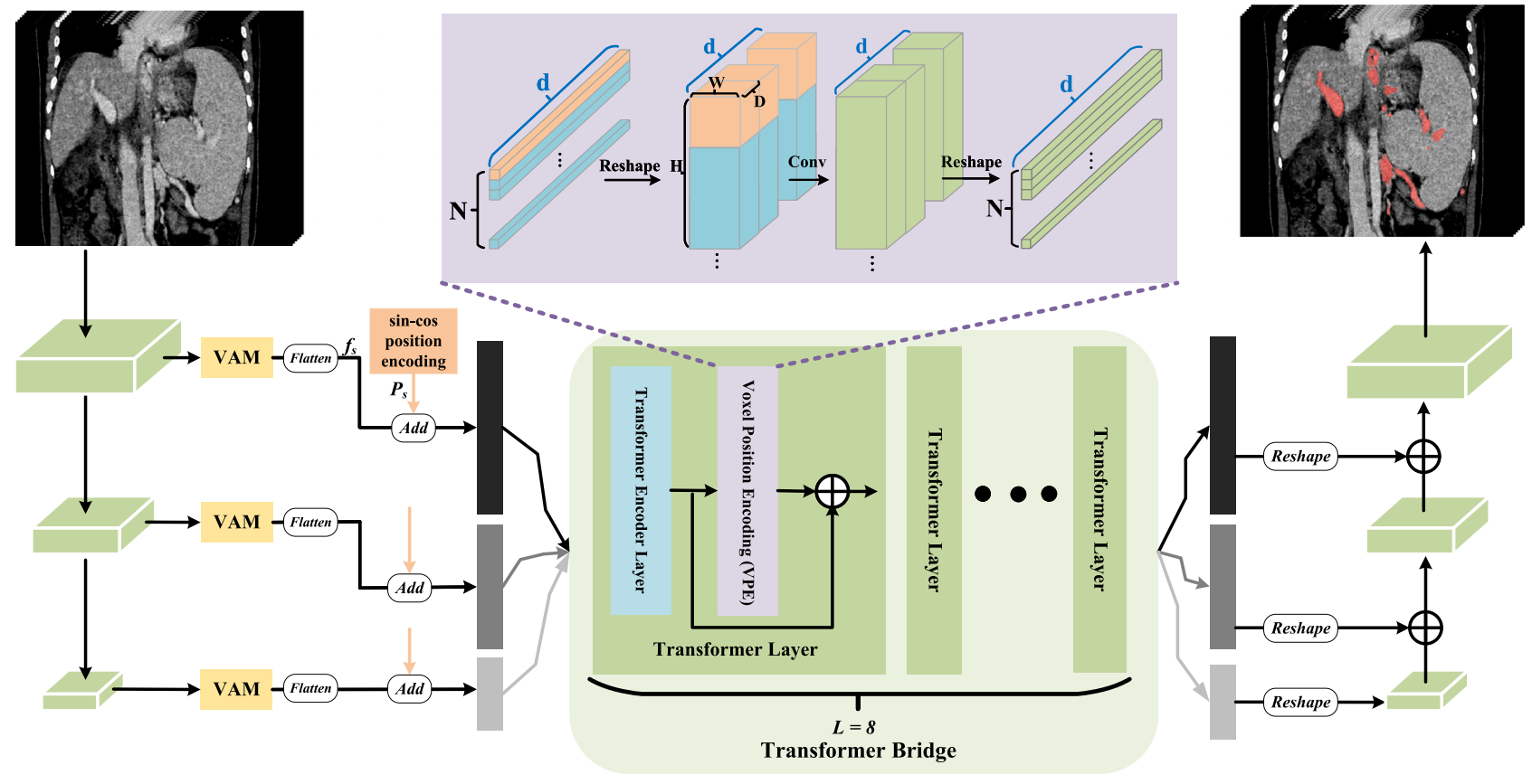 [MedIA] UDV-Net: A hybrid CNN and transformer vein segmentation network ...